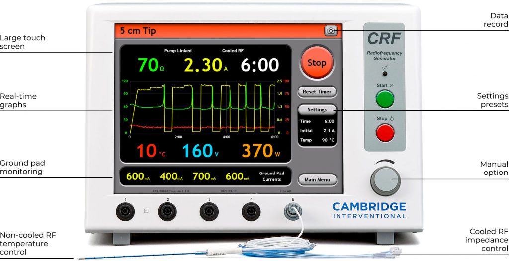 Thyroid Radiofrequency Ablation | Cambridge Interventional